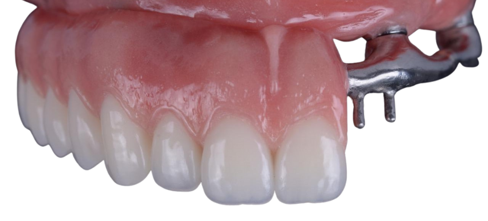 ModernaOdontto – Prótese Protocolo - modernaodontto.com.br